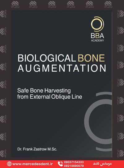BIOLOGICAL BONE AUGMENTATION Safe Bone Harvesting from External Oblique ...