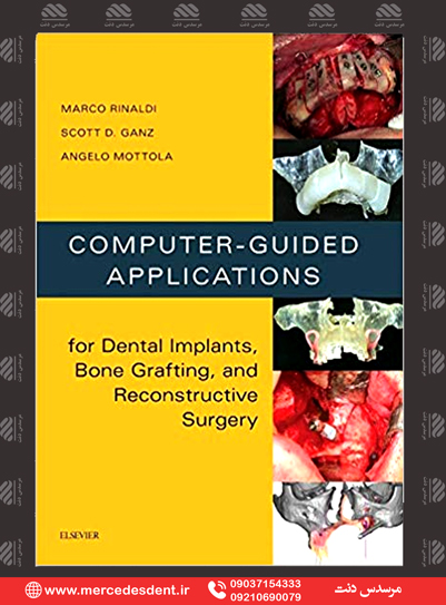 The Single-Tooth Implant : A Minimally Invasive Approach for Anterior ...