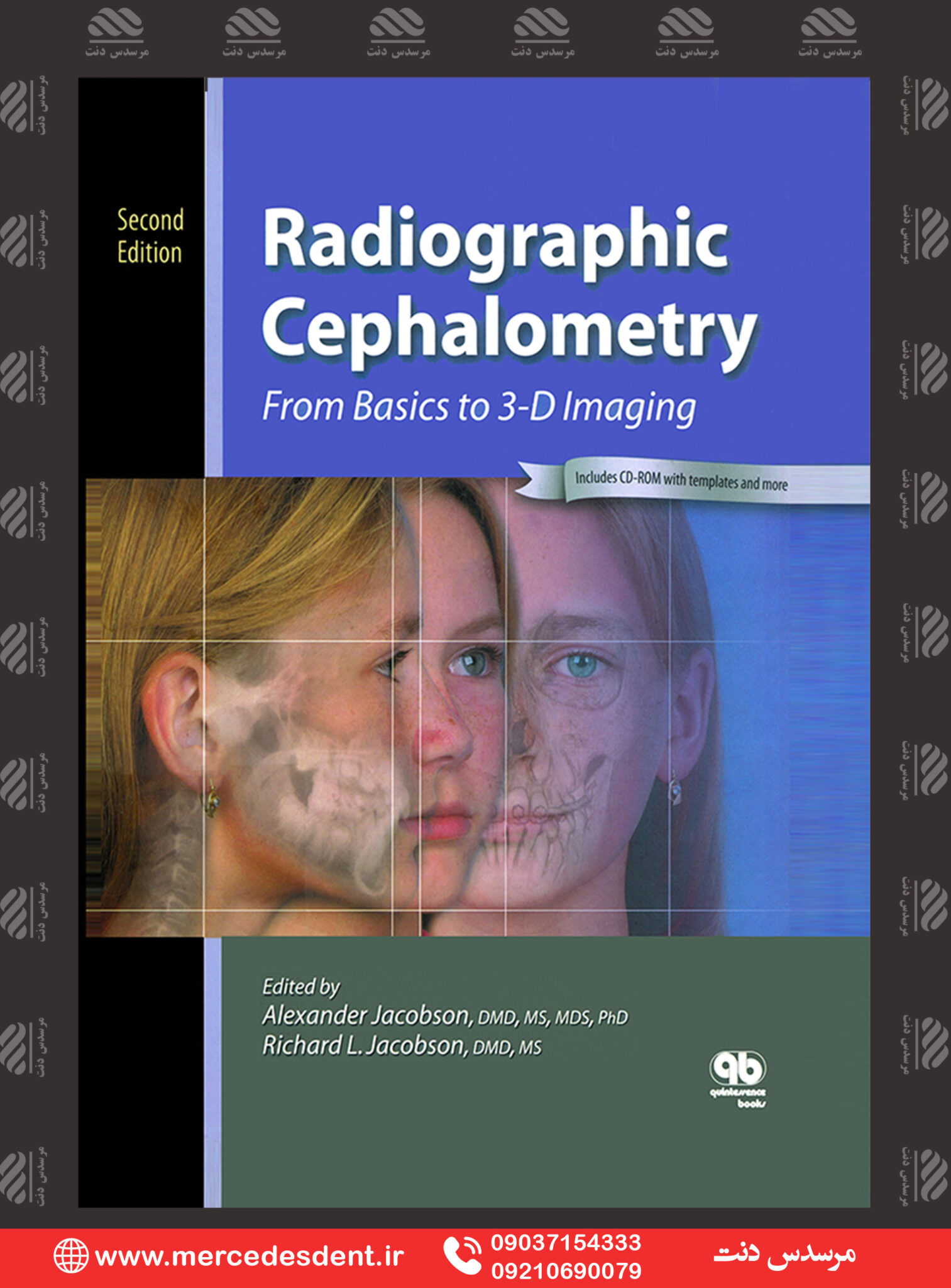 Radiographic cephalometry Jacobson - انتشارات دندانپزشکی مرسده (مرسدس ...