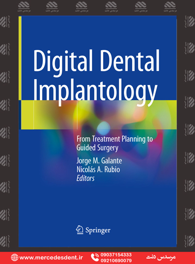 Digital Dental Implantology: From Treatment Planning to Guided Surgery ...